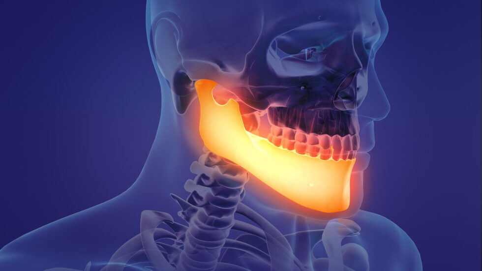 Why You May Need Jaw Surgery