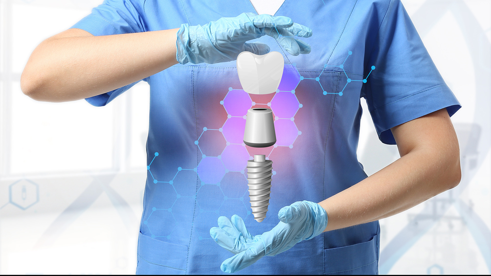 Ceramic vs. Titanium Implants: Which Is Right for You?